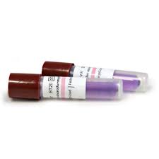 Biological Indicators for Steam Sterilization 24 Hours, 100/Box – 3BS ...